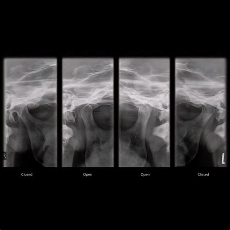 Digital Radiographs Deep Dental Clinic 9464964543