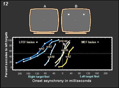 Slide Show The Neural Control Of Visually Guided Eye Movements C 8