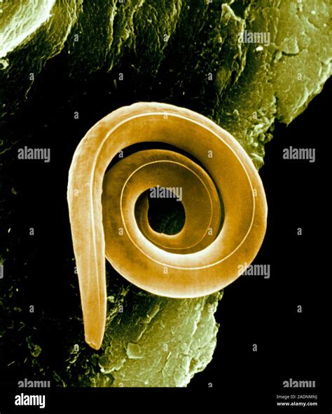 Nematode Worm Coloured Scanning Electron Micrograph Sem Nematode