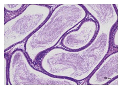 Pathological Observation Of Epididymis Epididymis Tissues Obtained At