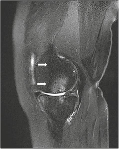 Clinical Feasibility Of Simultaneous Multislice Acceleration In Knee Mri Clinical Imaging
