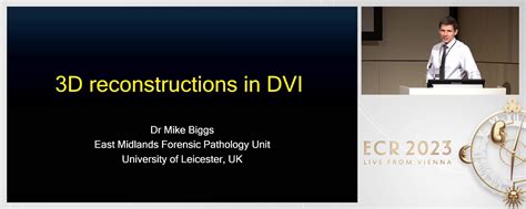 Disaster Victim Identification Dvi And Forensic Anthropology Esr