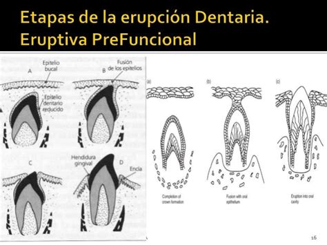 Erupción Dentaria