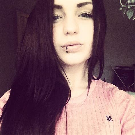 Kim 17 Svimmade I Köket Och Fick Kokhet Sås över Sig Så Ser Hon Ut Nu