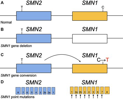 Spinal Muscular Atrophy Mutations Testing And Clinical Relevance Tacg Dove Medical Press