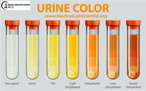 Urinalysis Physical Examination And Interpretation