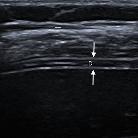Clinical Abdominal Scoring System Cass Download Scientific Diagram
