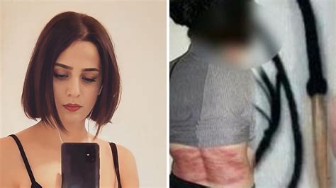 Iranian Woman Punished With 74 Lashes For Refusing To Wear Hijab