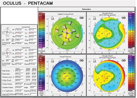 Surgical Options For The Treatment Of Hyperopia Eye News