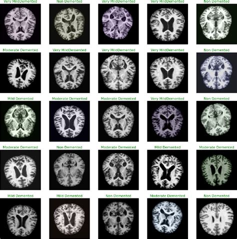 Leveraging Deep Learning And Xception Architecture For High Accuracy