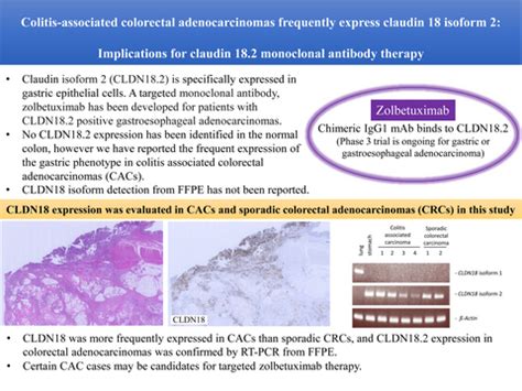Colitis‐associated Colorectal Adenocarcinomas Frequently Express