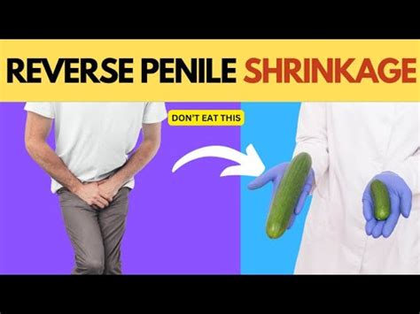 Easily Reversed Penile Shrinkage As You Age Youtube