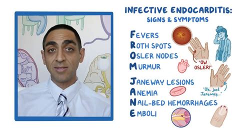 Endocarditis Symptoms Osler Nodes