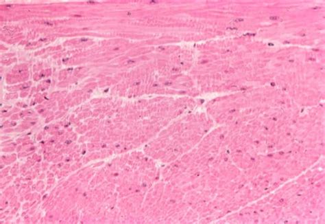 Iupui Lab Exam 2 Histology Slides Flashcards Quizlet