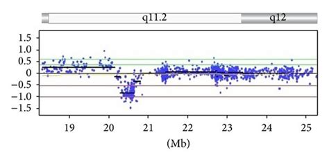 Chromosomal Microarray Analysis Of Case 1 Using The Combimatrix