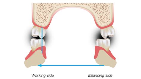 Occlusion And Occlusal Classifications From Orthodontic Prospect