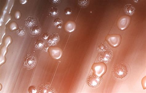 Free Picture Streptococcus Pneumoniae Bacteria Colonies Grown