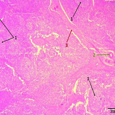 Histological Section Of The Mesenteric Lymph Node Stained With Download Scientific Diagram