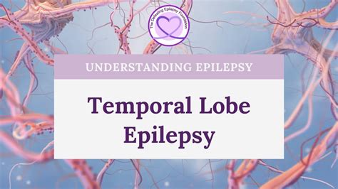 Causes Symptoms And Treatment For Temporal Lobe Epilepsy Youtube