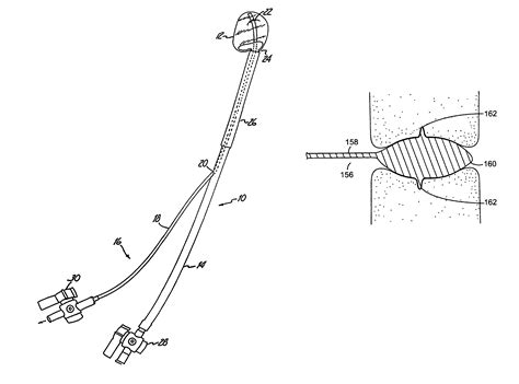 Intervertebral Disc Prosthesis Eureka Patsnap