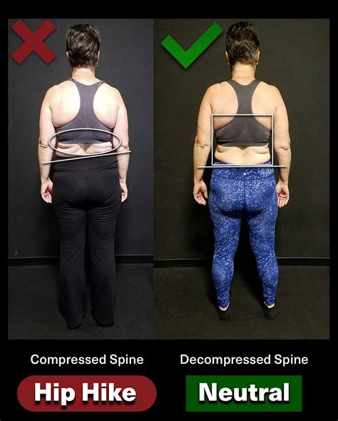 Functional Patterns Scientific Evidence Posture Back And Hip Pain