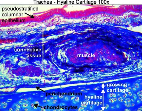 Tracheal Cartilage Histology
