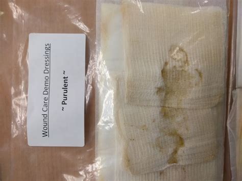 Purulent Drainage On Gauze