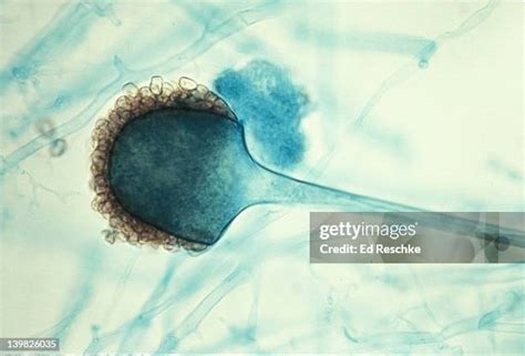 Spore Microscope Photos And Premium High Res Pictures Getty Images