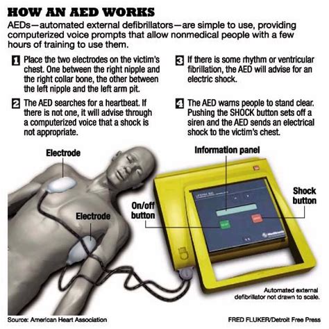 How Strong Is An Aed Shock At Christopher Lewis Blog