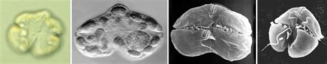 Scientifict Neurotoxic Shellfish Poisoning