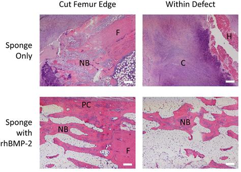 A Reliable And Reproducible Critical Sized Segmental Femoral Defect