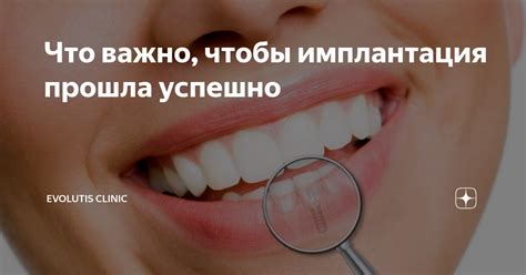 Что важно, чтобы имплантация прошла успешно | Evolutis Clinic | Дзен