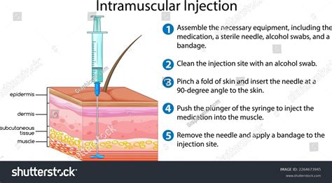 Intramuscular Injection Explanation Illustration Stock Vector Royalty