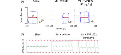 Preserved Lv Function Heart