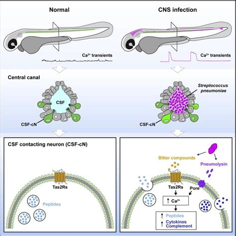 On Linkedin Sensory Cells Taste Cerebrospinal Fluid To Fight
