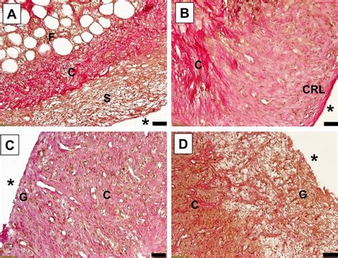 Representative Paraffin Sections Of Induced Membranes Elastica Van