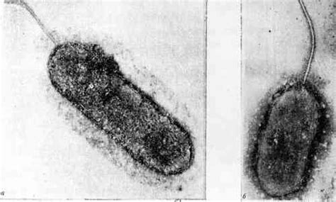 Acidithiobacillus Thiooxidans Alchetron The Free Social Encyclopedia