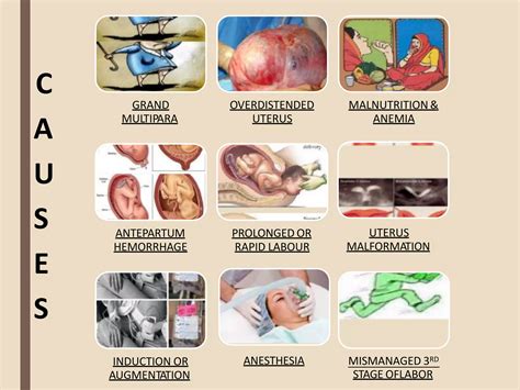 Complications Of 3 Rd Stage Of The Labour Pptx