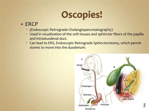 Ppt General Procedures Powerpoint Presentation Free Download Id