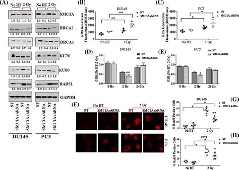 Smc1a Is Associated With Radioresistance In Prostate Cancer And Acts By