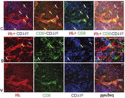 Distribution Of Nerve Fibres Cd8 Cytotoxic T Cells And Dcs In The
