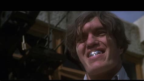 Bond Jaws Girlfriend Braces At Francis Holston Blog