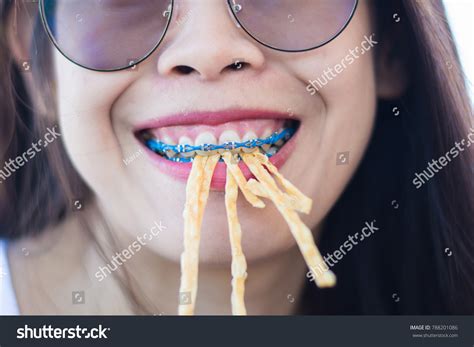 1264 Imágenes De Eating With Dental Braces Imágenes Fotos Y