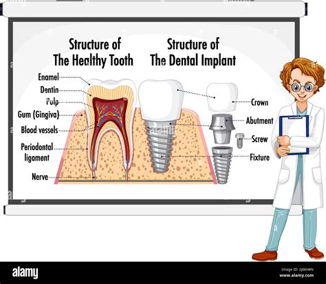 Infographic Of Human In Structure Of The Healthy Tooth Illustration