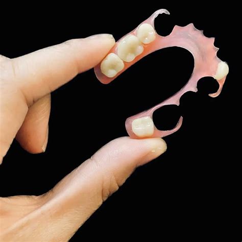 Metal Partial Vs Flexible Partial Denture Choices New Smile Dentures