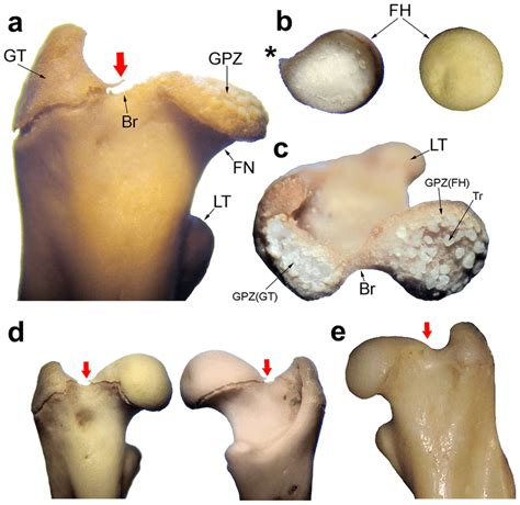 Detail Of The Coalesced Ossification Of The Femoral Head Fh And Download Scientific Diagram