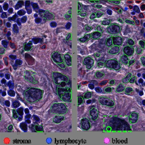 nuclei segmentation results for different models on a testing lung