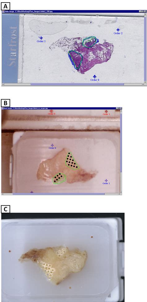 Tissue Microarrayer For High Throughput Analysis Of Pathology Tissue