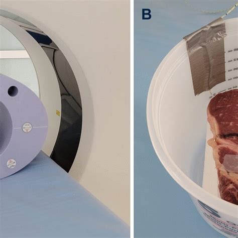 Spectral Physical Density Quantifications At Different Doses