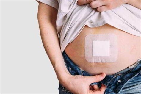 Hernia Treatment In Mysore Top Surgeons Low Cost Operation